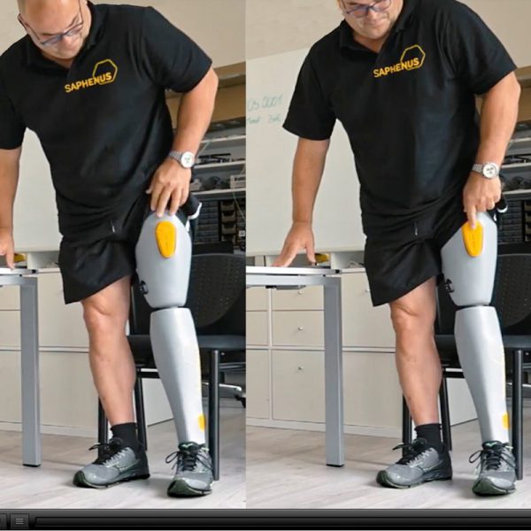 SURALIS-The feeling leg prosthesis – BIG SEE Make Sense